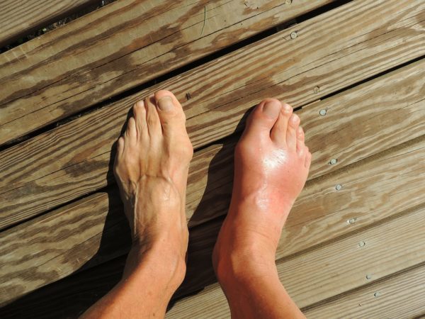 7 Common Foot and Ankle Injuries and Disorders - Washington Orthopaedic ...