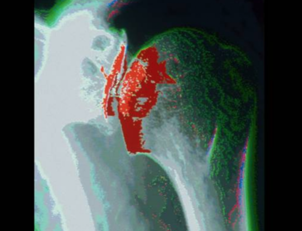 The Meaning of Our Tree - Washington Orthopaedic Center